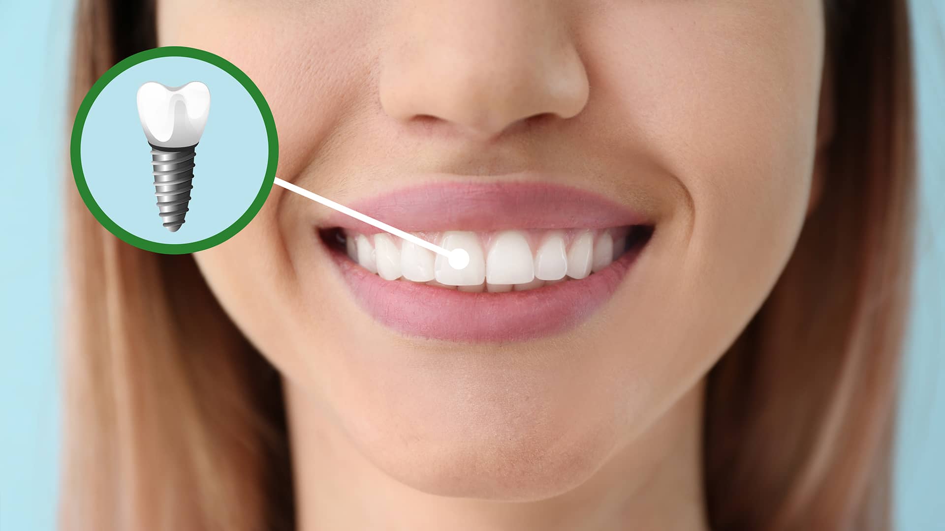 Oral Surgeon Brooklyn | Oral Surgeon Paramus | Pristine Oral ...